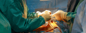 Difference Between Bypass Surgery and Open Heart Surgery